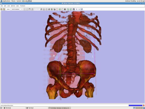 Slicer3:Volume Rendering - Slicer Wiki