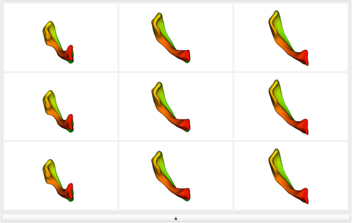 Documentation/Nightly/Extensions/ShapePopulationViewer - Slicer Wiki