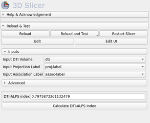 Documentation/Nightly/Extensions/DTI ALPS - Slicer Wiki