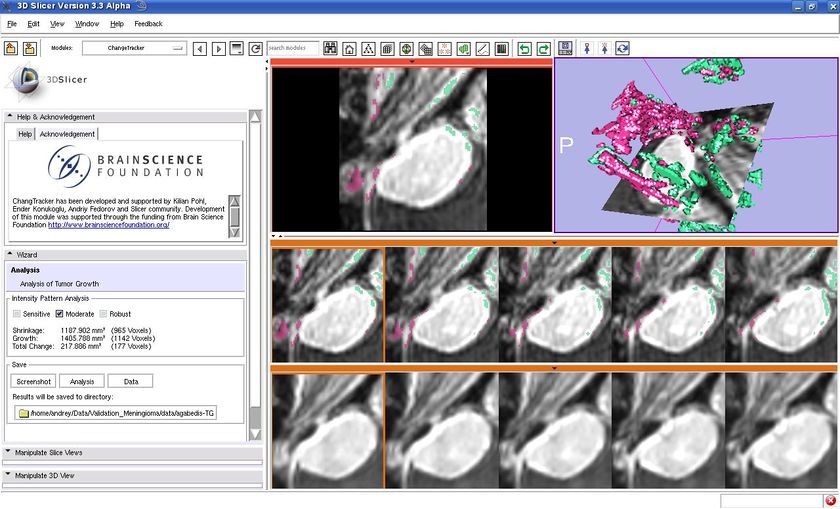 Modules:ChangeTracker-Documentation-3.4 - Slicer Wiki