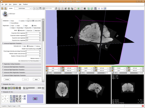 Slicer3:LinearRegistrationUseCases - Slicer Wiki