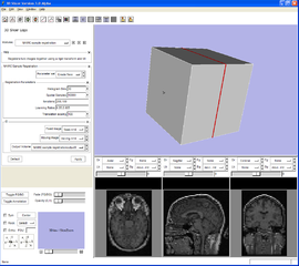 Slicer3:VisualBlog - Slicer Wiki