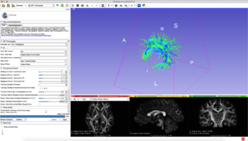 Documentation/Nightly/Modules/UKFTractography - Slicer Wiki