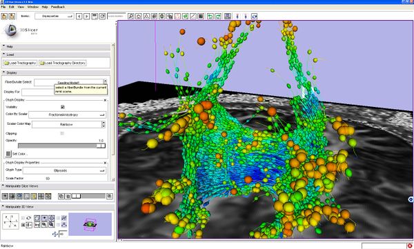 Slicer3:DTMRI - Slicer Wiki