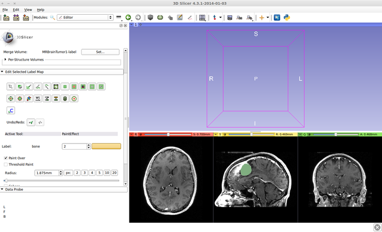 Documentation/4.10/Modules/CarreraSliceInteractiveSegmenter - Slicer Wiki