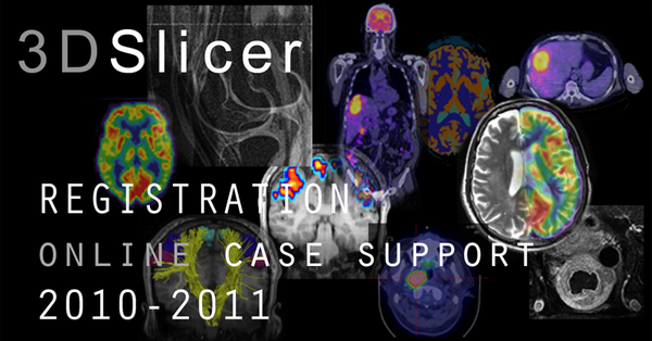 Slicer3:Registration - Slicer Wiki