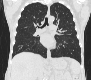 SampleData - Slicer Wiki