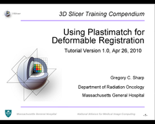 Documentation/4.8/Extensions/Plastimatch - Slicer Wiki