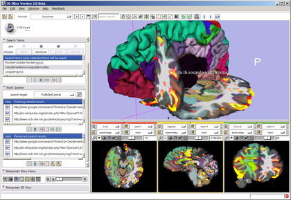 Slicer3:Module:QueryAtlas - Slicer Wiki
