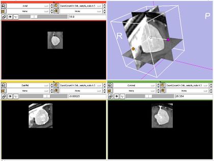 Modules:CropVolume-Documentation-3.6 - Slicer Wiki