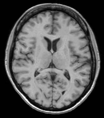 Modules:BRAINSFit - Slicer Wiki