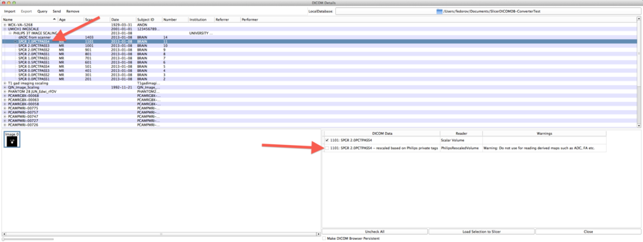 Documentation/4.10/Extensions/DICOMPhilipsRescalePlugin - Slicer Wiki