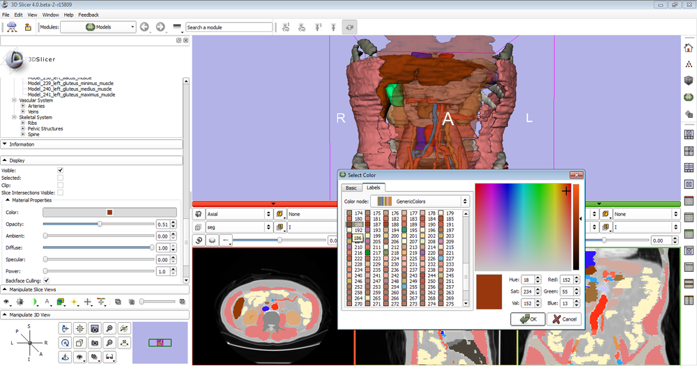 Documentation/Nightly/Developers/ImageGallery - Slicer Wiki