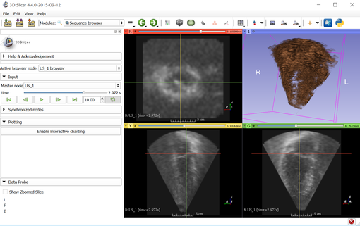 Documentation/4.8/Extensions/SlicerHeart - Slicer Wiki