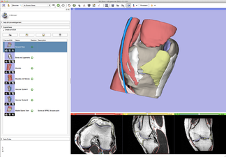 Documentation/4.0/Announcements - Slicer Wiki
