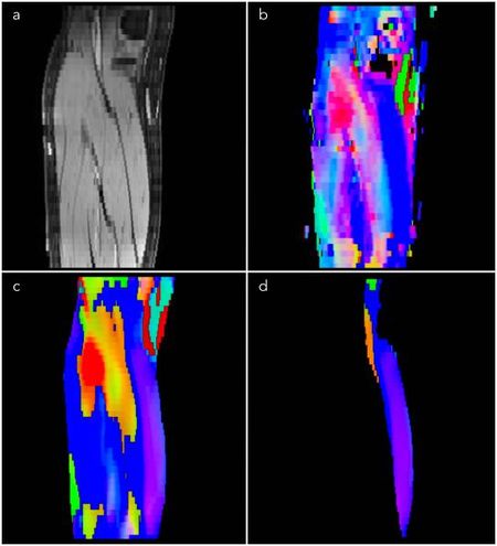 Main Page/SlicerCommunity/2015 - Slicer Wiki