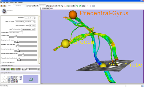 Announcements:Slicer3.4 - Slicer Wiki