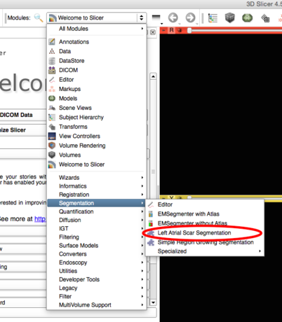 Documentation/4.5/SlicerApplication/ExtensionsManager - Slicer Wiki