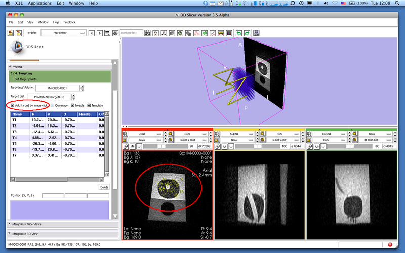 Modules:ProstateNav-Documentation-3.6 - Slicer Wiki