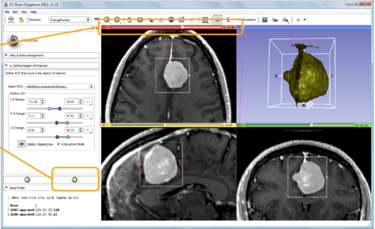 Documentation/4.6/Training - Slicer Wiki