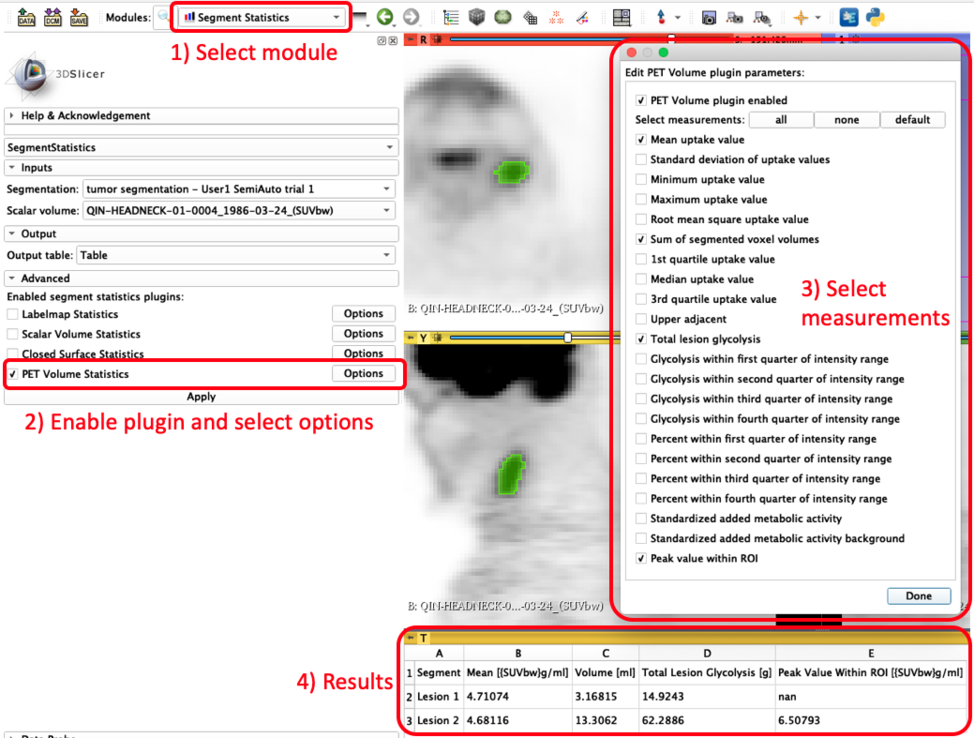 Documentation/Nightly/Modules/PETVolumeSegmentStatisticsPlugin - Slicer Wiki