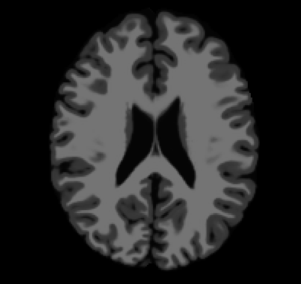 Documentation/4.10/Modules/BrainLogisticSegmentation - Slicer Wiki