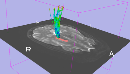 Modules:ROISelect-Documentation-3.6 - Slicer Wiki