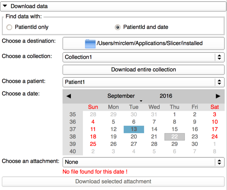 Documentationnightlymodulesdatabaseinteractor Slicer Wiki