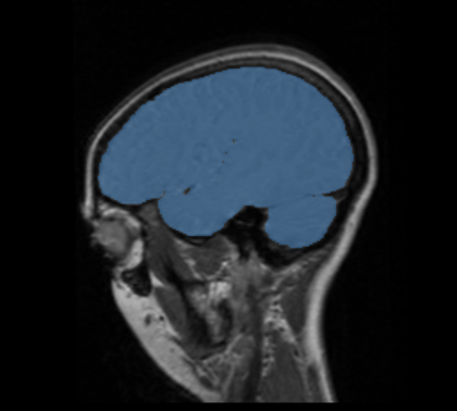 Documentation/Nightly/Modules/BRAINSMush - Slicer Wiki