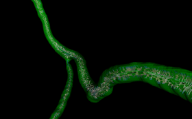 Modules:VMTK in 3D Slicer Tutorial: Coronary Artery Centerline Extraction - Slicer Wiki