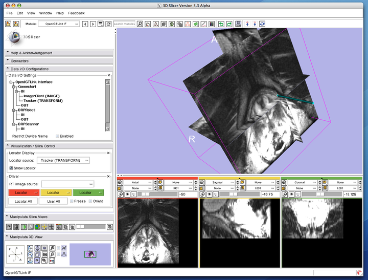 Modules:OpenIGTLinkIF-Documentation-3.6 - Slicer Wiki