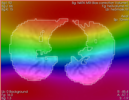 Modules:N4ITKBiasFieldCorrection-Documentation-3.6 - Slicer Wiki