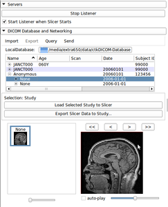 Documentation/4.0/Announcements - Slicer Wiki