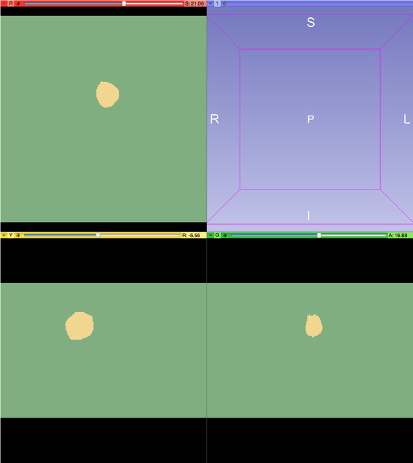 Documentation/4.8/Modules/Editor/WatershedFromMarkers - Slicer Wiki