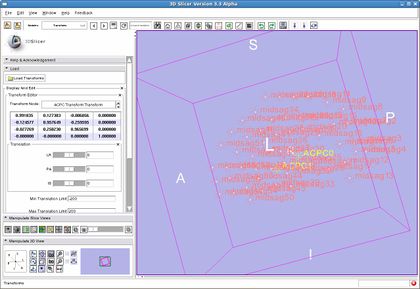 Modules:ACPCTransform-Documentation-3.6 - Slicer Wiki