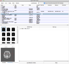Documentation/4.2/Announcements - Slicer Wiki