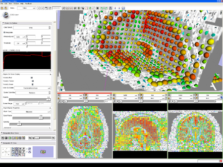 Slicer3:DTMRI - Slicer Wiki