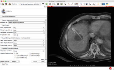 Documentation/4.4/Training - Slicer Wiki