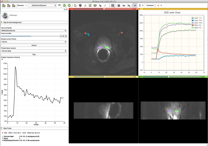 Documentation/4.2/Modules/MultiVolumeExplorer - Slicer Wiki
