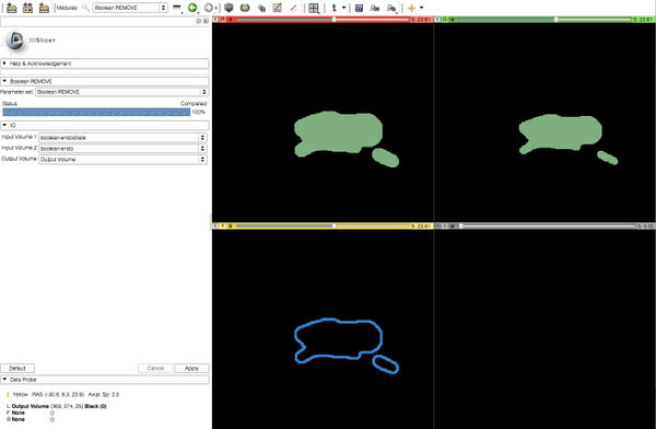 Documentation/Nightly/Modules/SlicerModuleBooleanRemove - Slicer Wiki