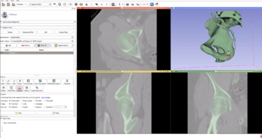 Documentation/4.8/Training - Slicer Wiki