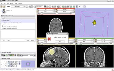 Modules:ChangeTracker-Documentation-3.4 - Slicer Wiki