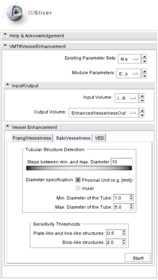 Modules:VMTK in 3D Slicer Tutorial: Coronary Artery Centerline Extraction - Slicer Wiki