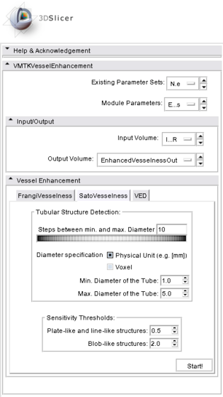 Modules:VMTK in 3D Slicer Tutorial: Coronary Artery Centerline ...