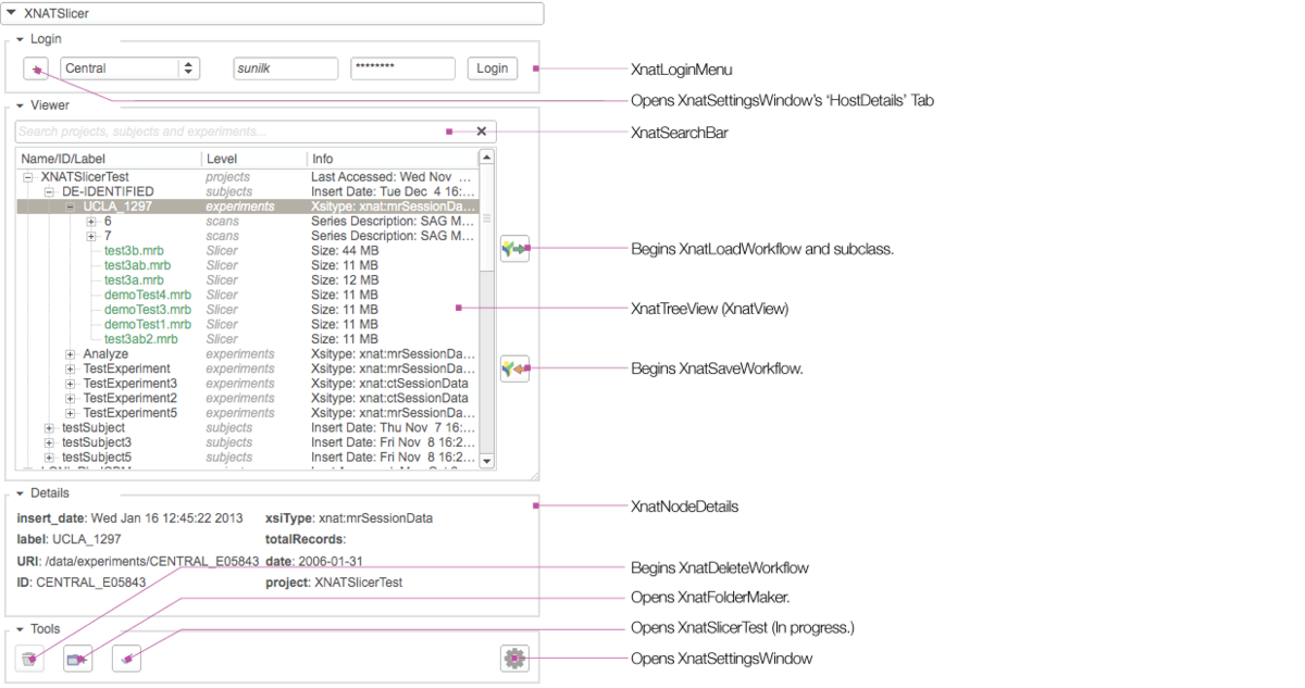 Documentation/Nightly/Extensions/XNATSlicer - Slicer Wiki