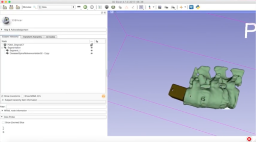 Documentation/4.8/Training - Slicer Wiki