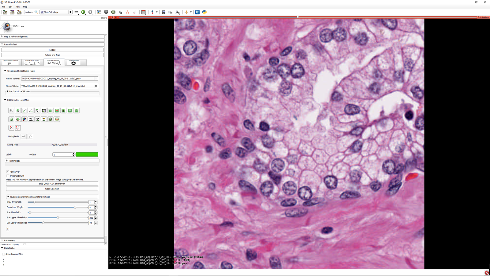 Documentation/4.8/Extensions/SlicerPathology - Slicer Wiki