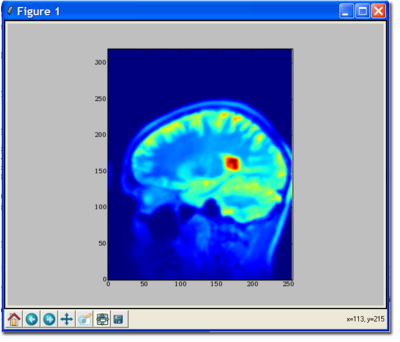 Slicer3:VisualBlog Extension - Slicer Wiki