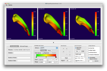 Documentation/Nightly/Extensions/ShapePopulationViewer - Slicer Wiki