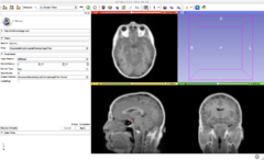 Documentation/4.4/Modules/SimpleFilters - Slicer Wiki